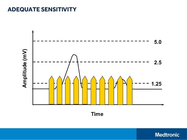 Basic pacing concepts