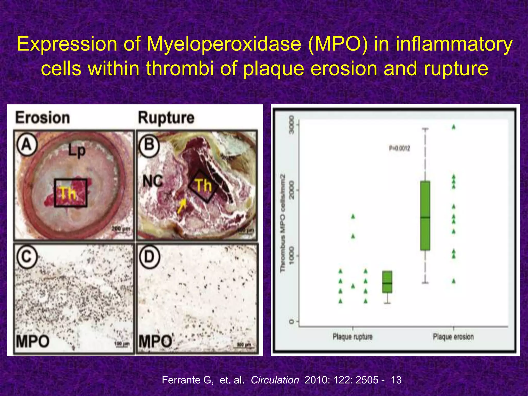 Basic pathogenesis of atherothrombosis | PPTX