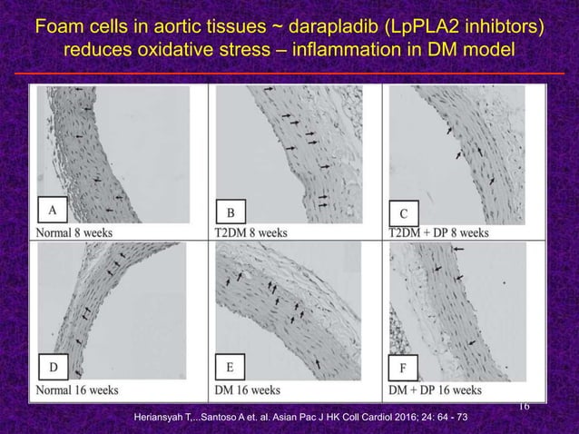 Basic pathogenesis of atherothrombosis | PPTX