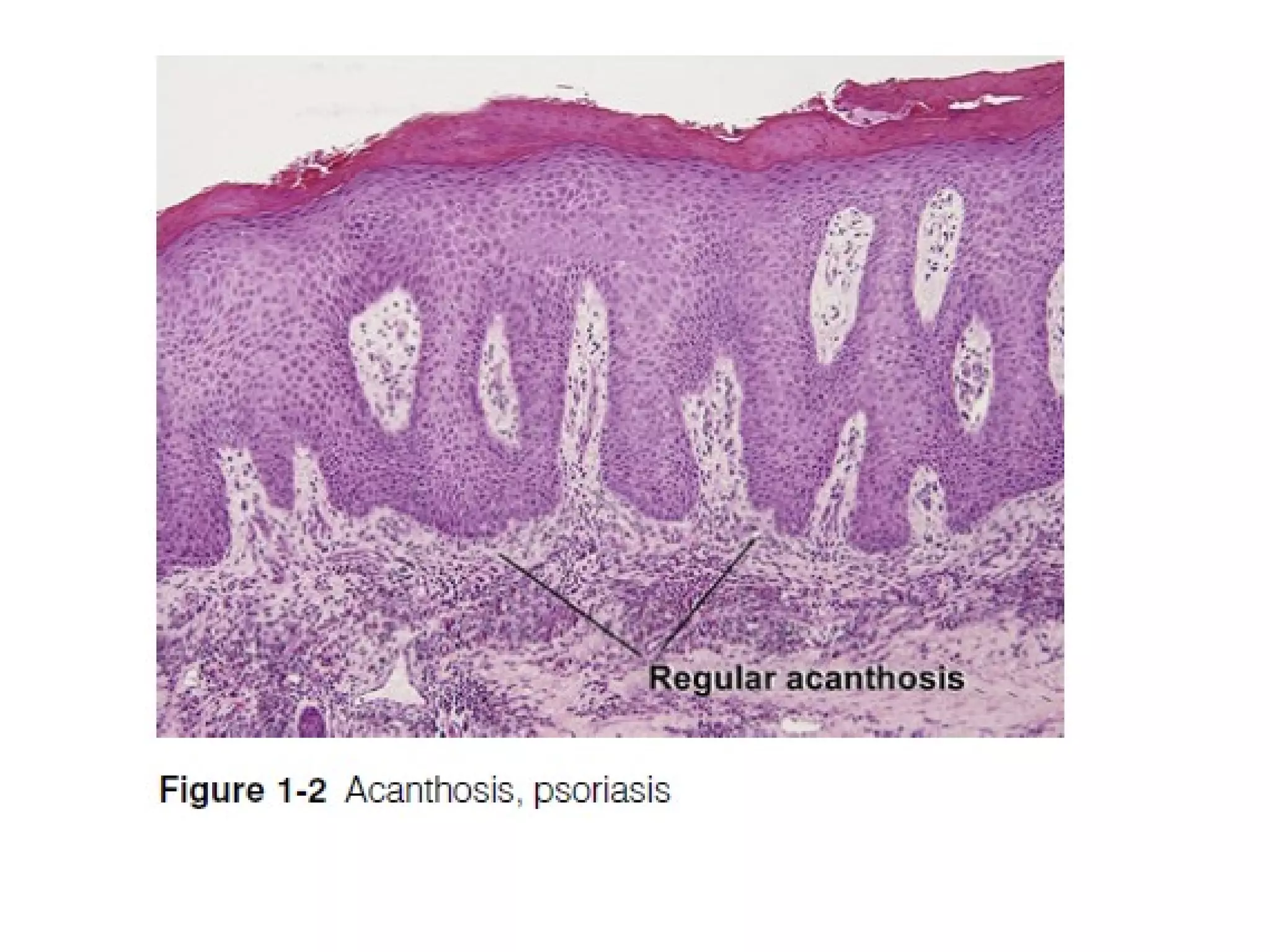 Basic Pathological Reactions of the Skin - Dr Zainab Almossalli | PPT