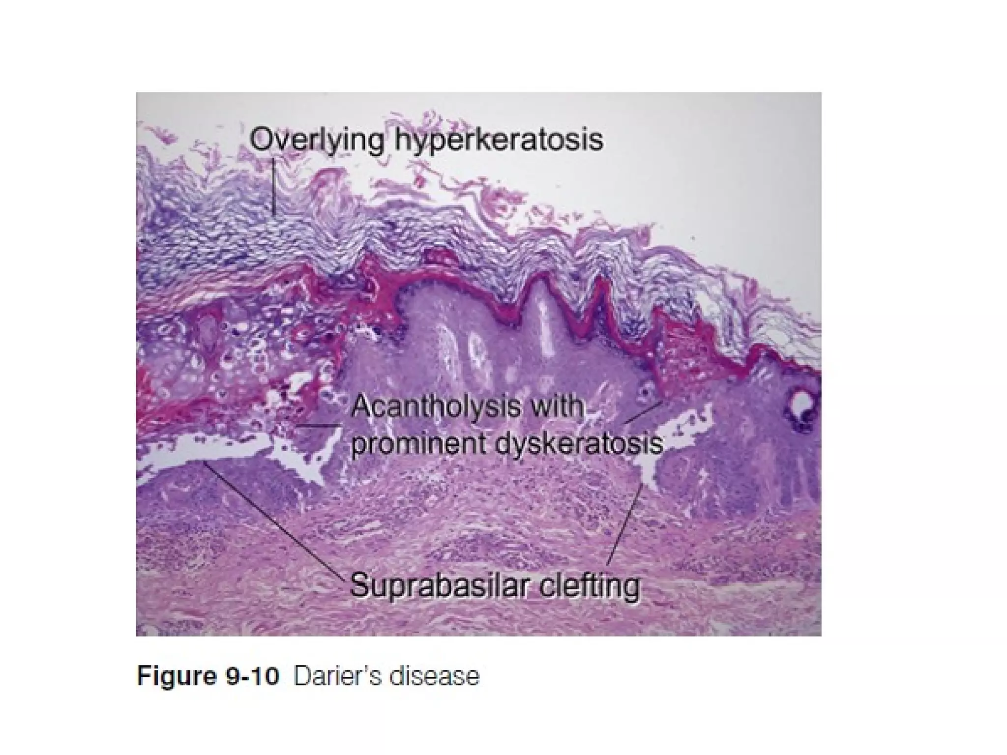 Basic Pathological Reactions of the Skin - Dr Zainab Almossalli | PPT