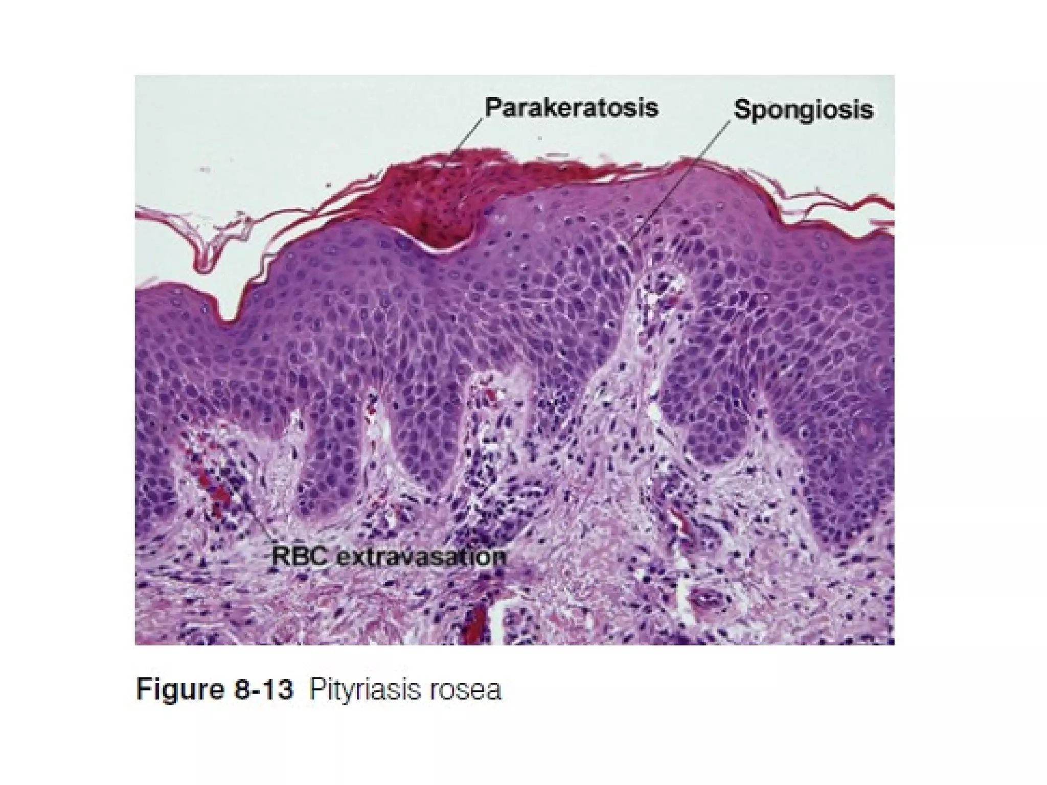 Basic Pathological Reactions of the Skin - Dr Zainab Almossalli | PPT
