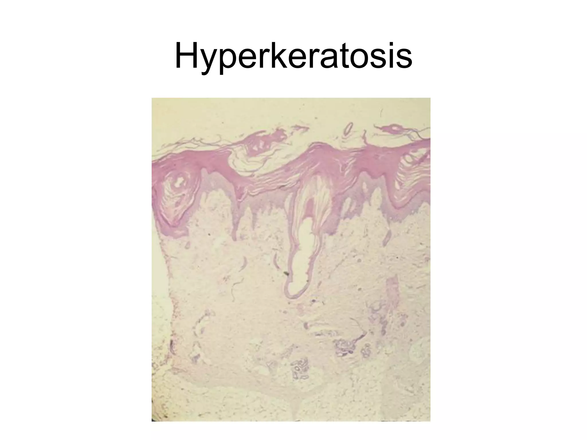 Basic pathologic skin reactions-Dr Kibbi.ppt
