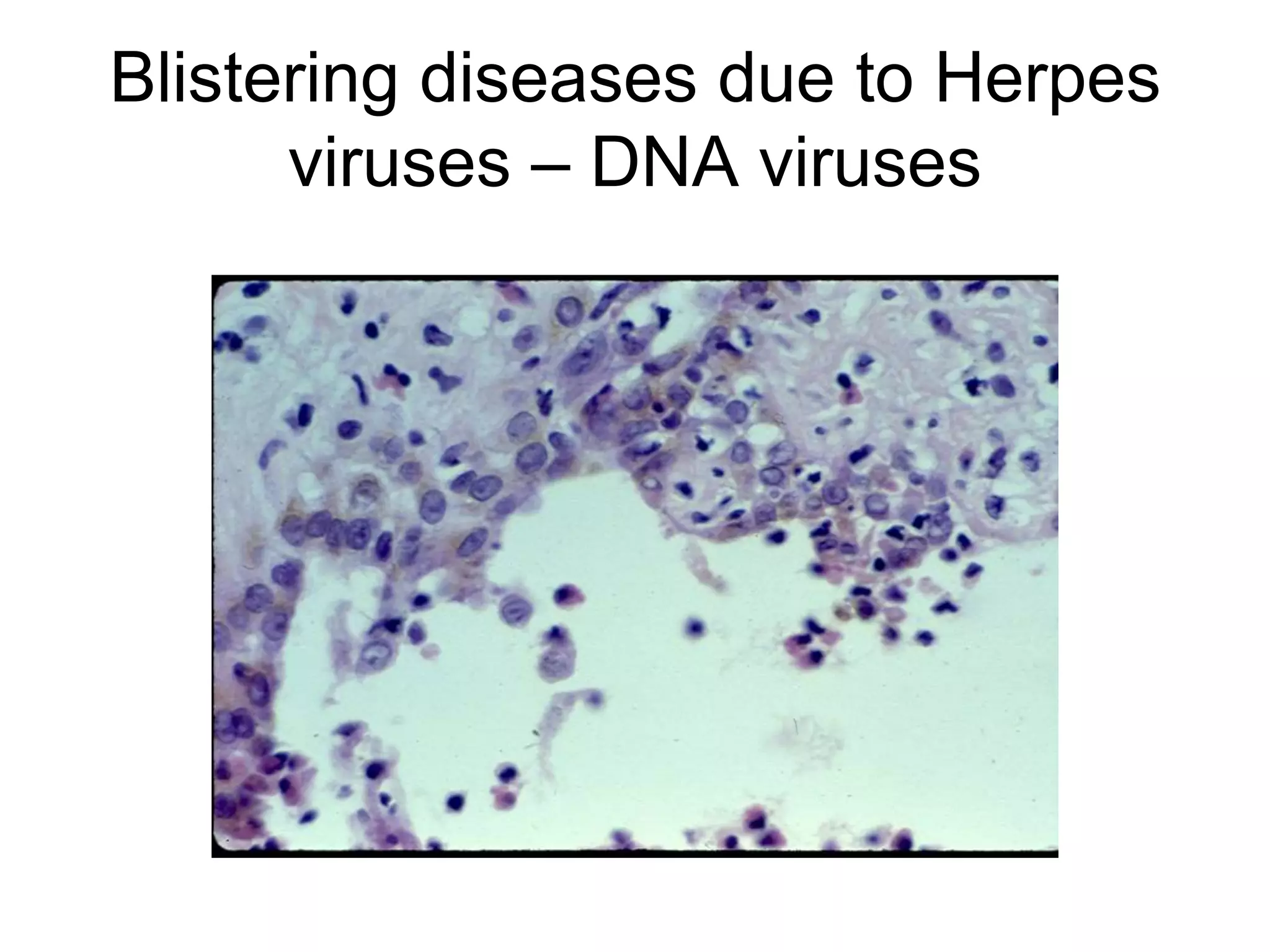 Basic pathologic skin reactions-Dr Kibbi.ppt