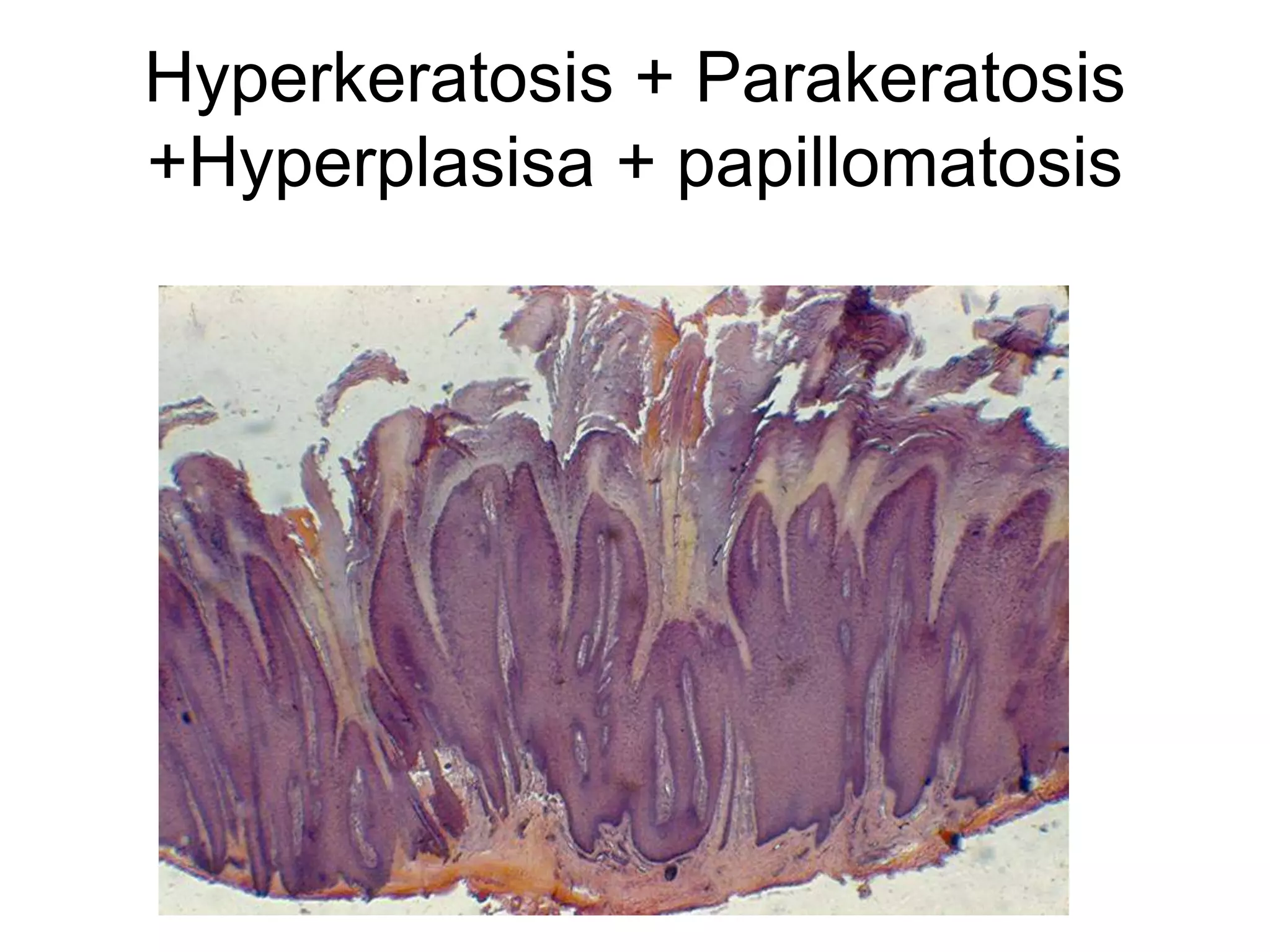 Basic pathologic skin reactions-Dr Kibbi.ppt