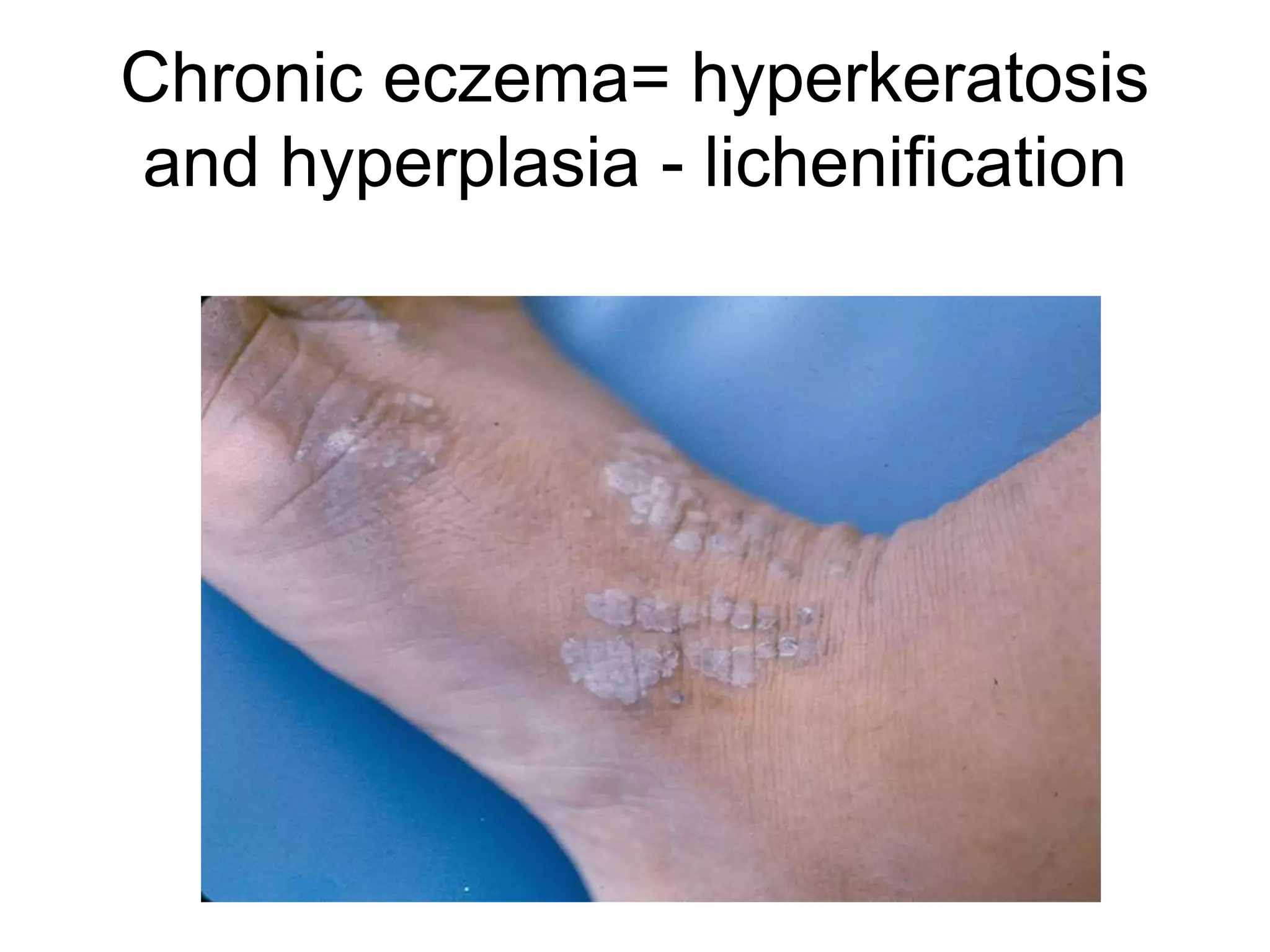 Basic pathologic skin reactions-Dr Kibbi.ppt