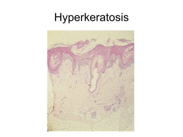 Basic pathologic skin reactions-Dr Kibbi.ppt