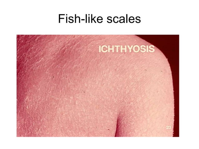 Basic pathologic skin reactions-Dr Kibbi.ppt | Free Download