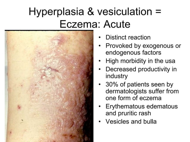 Basic pathologic skin reactions-Dr Kibbi.ppt