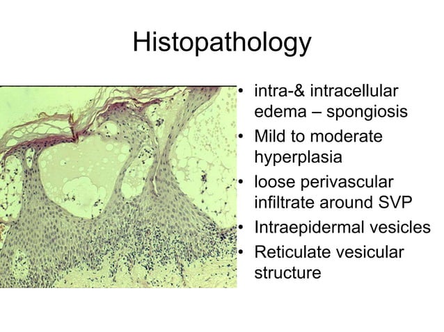 Basic pathologic skin reactions-Dr Kibbi.ppt