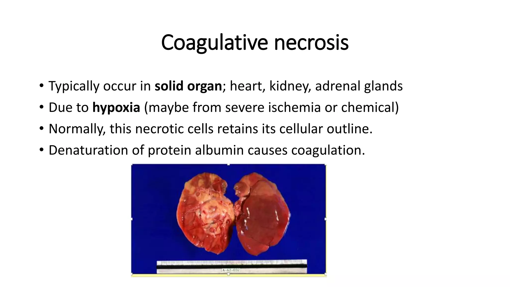 Basic Pathology II.pptx