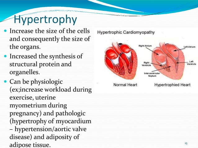 Basic pathophysiology.pptx