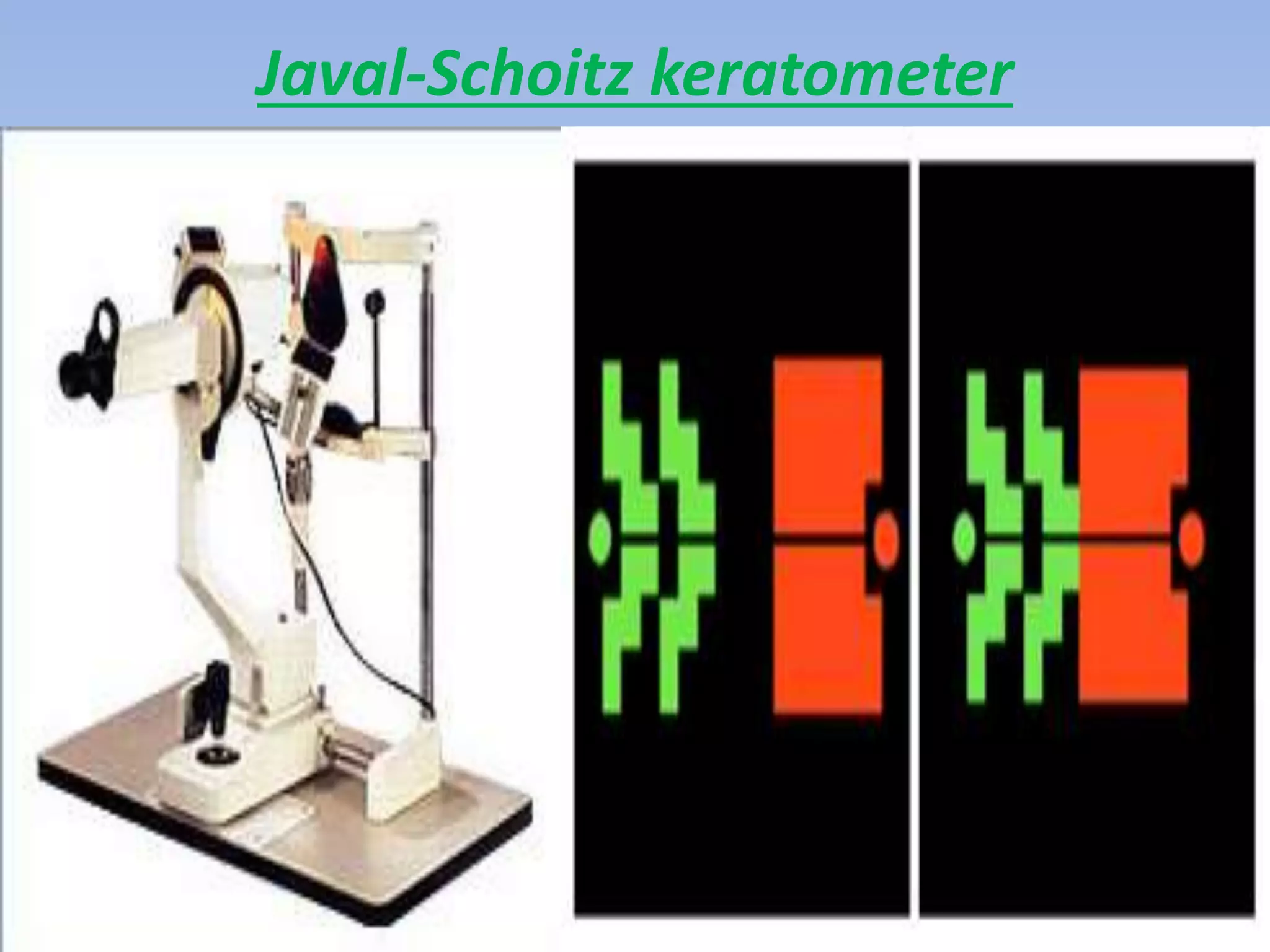 Basic pentcam for refractive surgery decision | PPTX