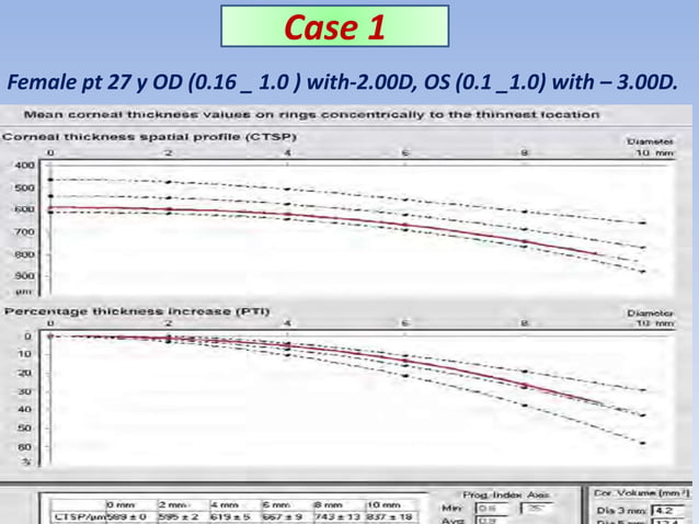 Basic pentcam for refractive surgery decision | PPTX | Eye and Vision ...