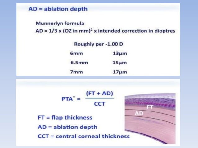 Basic pentcam for refractive surgery decision | PPTX | Eye and Vision ...