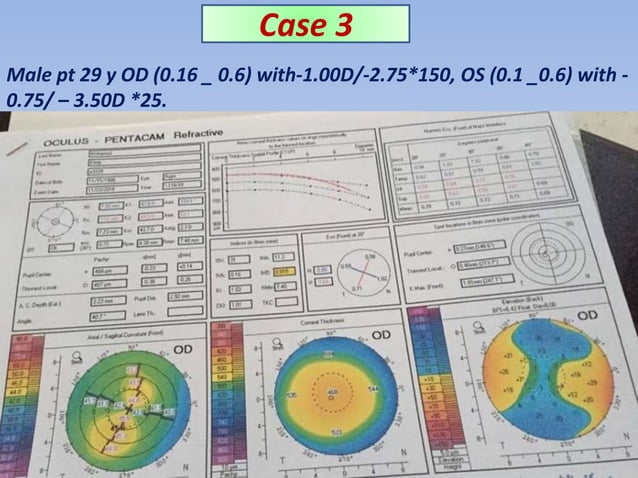 Basic pentcam for refractive surgery decision | PPTX | Eye and Vision ...