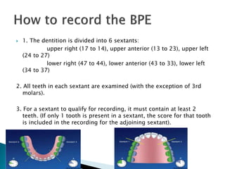 Basic periodontal examination | PPTX