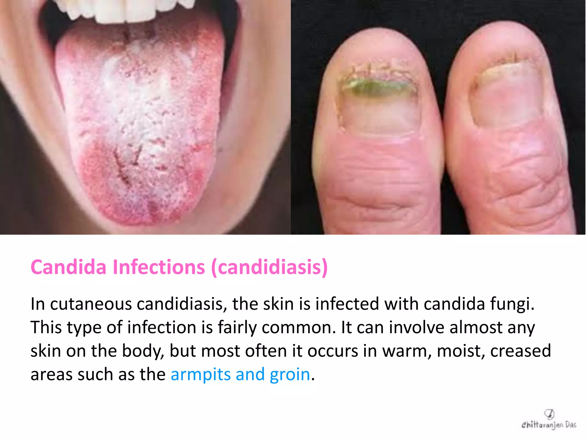 Introduction to Basic Pharmaceutical Microbiology | PPTX