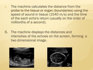 Basic physics of Ultrasound | PPT