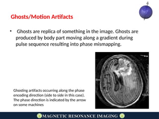 BASIC PHYSICS OF MRI AND ITS ADVANCEMENTS BY Joginder.pptx