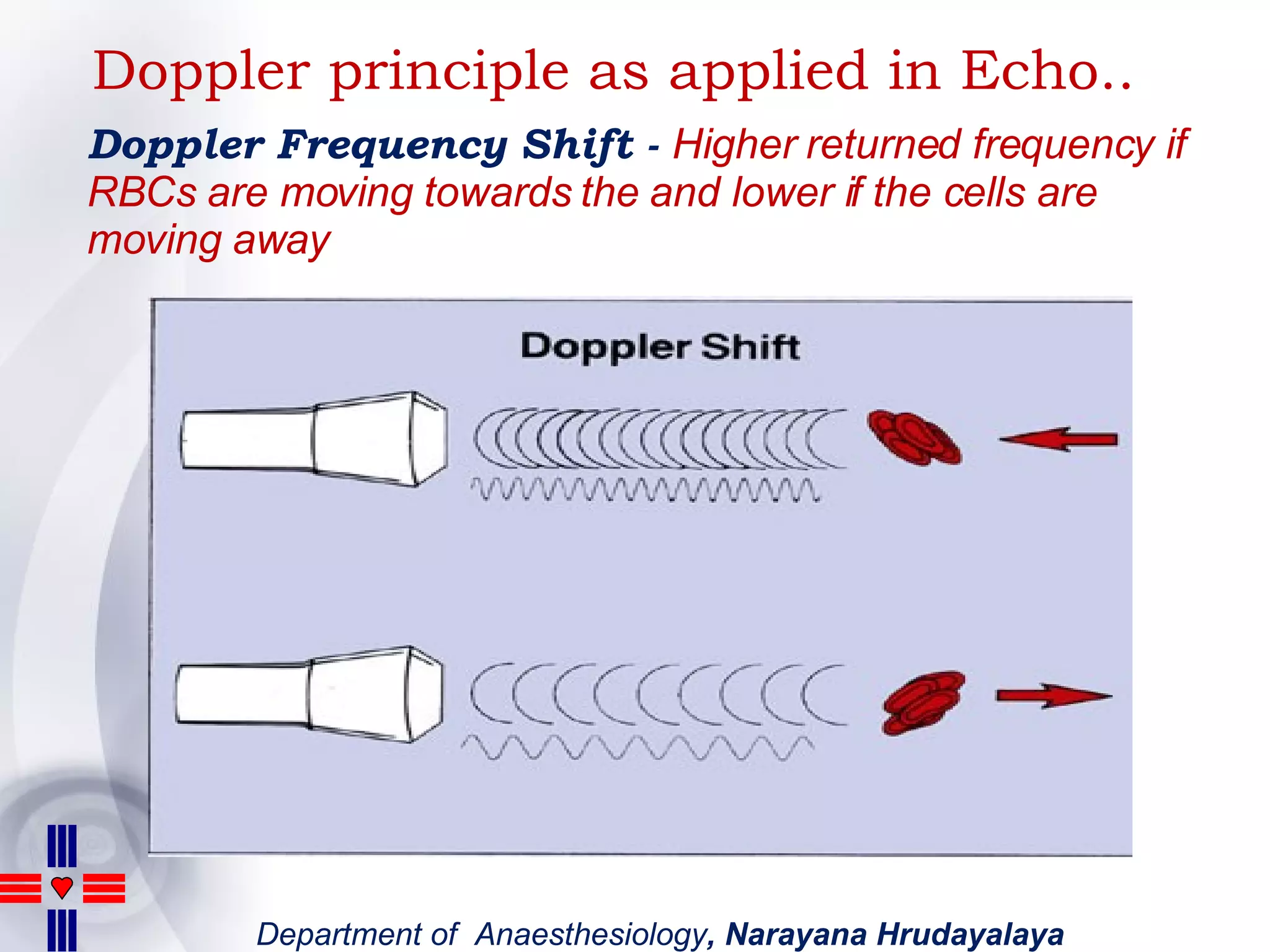 Basic Physics Of Transoesophageal Echocardiography For The Workshop2 | PPT