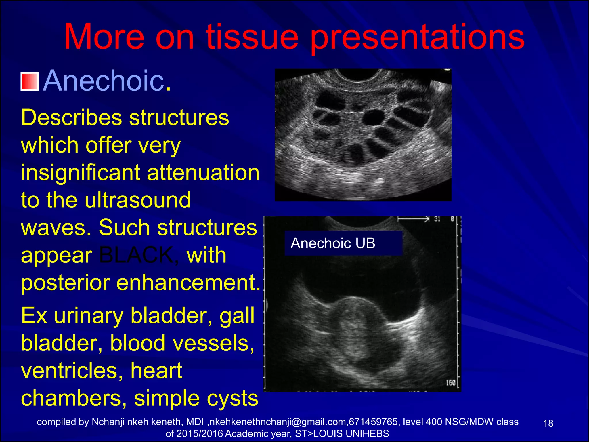 Basic physics of ultrasound | PDF