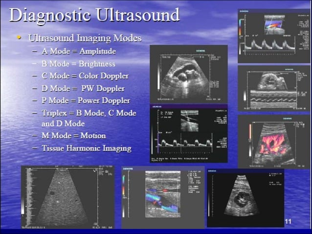 Basic physics of ultrasound | PDF