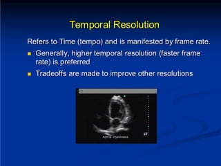 Basic Physics of Ultrasound. For sonar device | PPT