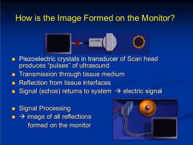 Basic Physics of Ultrasound. For sonar device | PPT