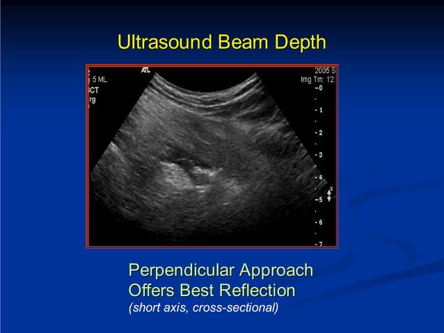Basic Physics of Ultrasound.pdf lecture of sonar | PPT