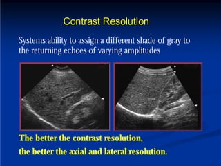 Basic Physics of Ultrasound.sonar device | PPT