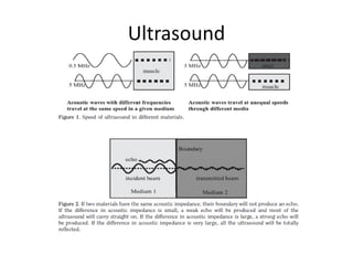 Basic physics of ultrasound imaging | PPTX