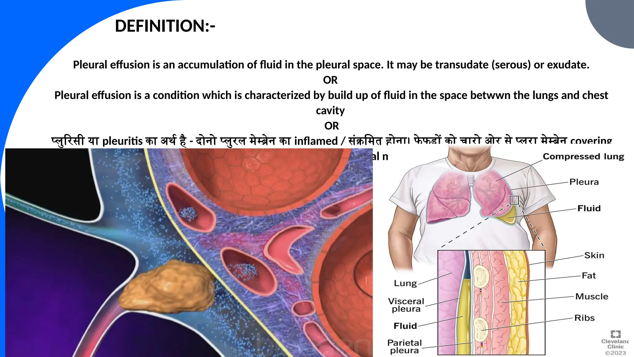 COPD MEDICAL SURGICAL NURSING presentation.pptx