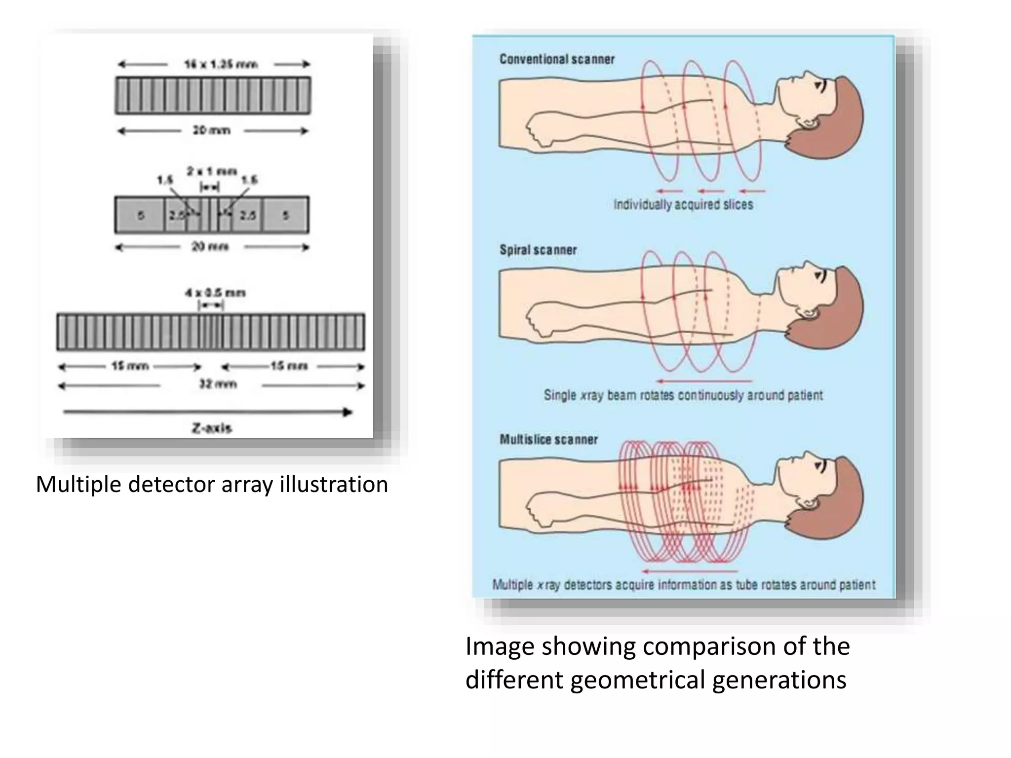 Basic principle of ct and ct generations | PPTX