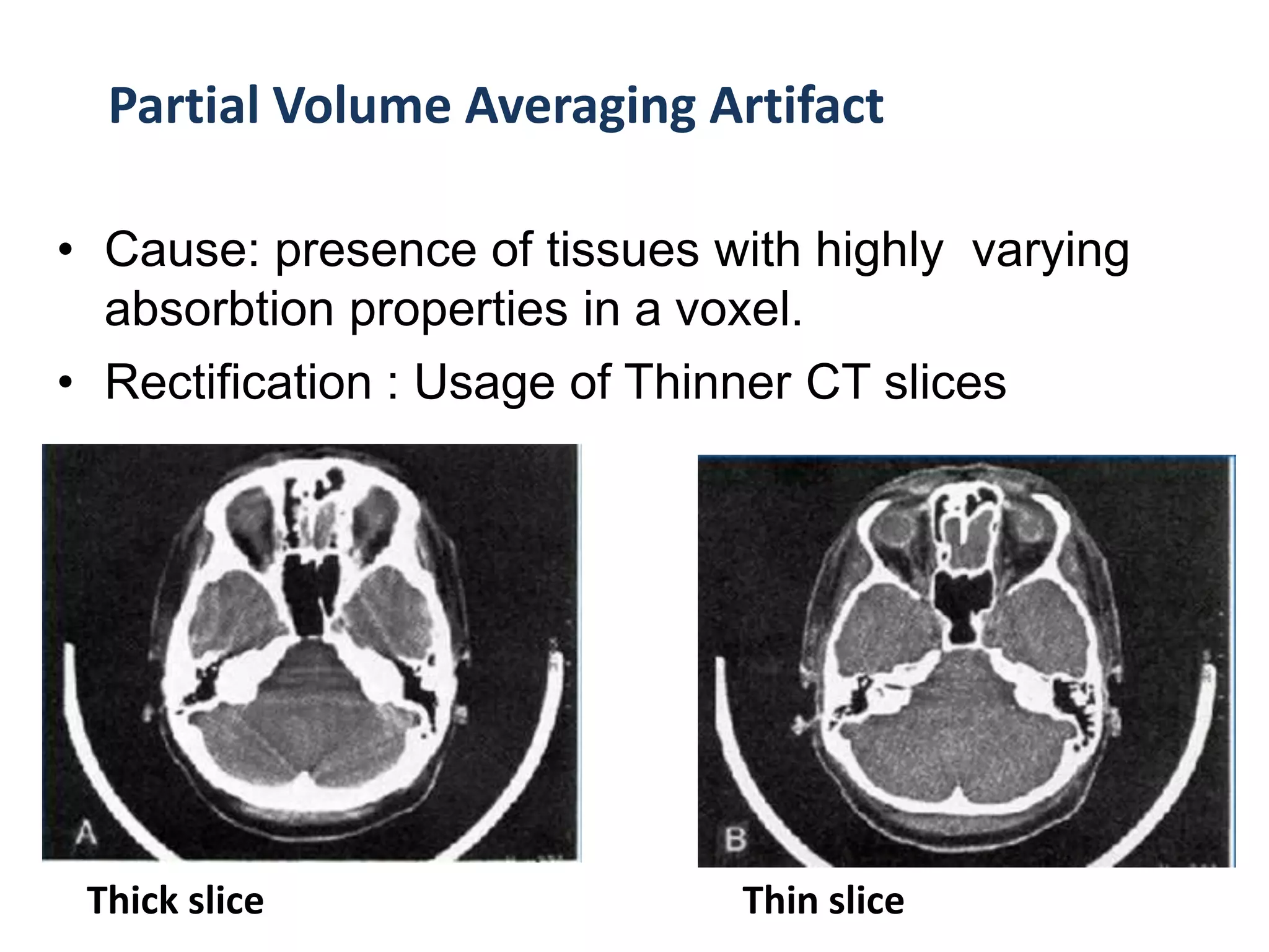 Basic principle of ct and ct generations | PPTX