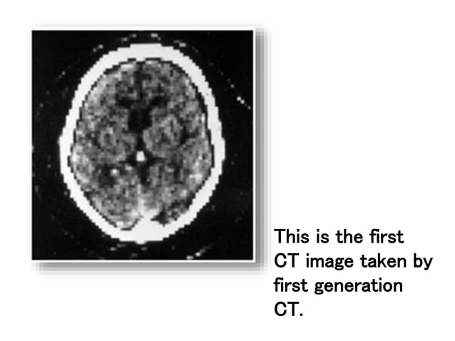 Basic principle of ct and ct generations | PPTX