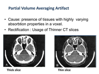 Basic principle of ct and ct generations | PPTX