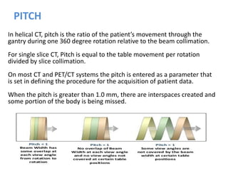 Basic principle of ct and ct generations | PPT