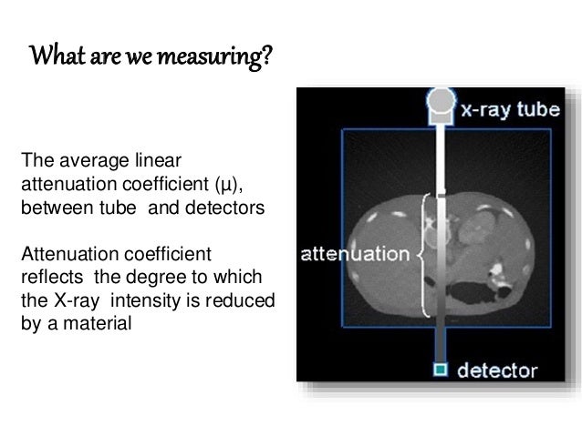 Basic principle of ct and ct generations