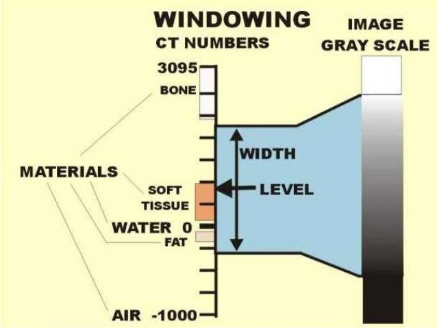 Basic principle of ct and ct generations