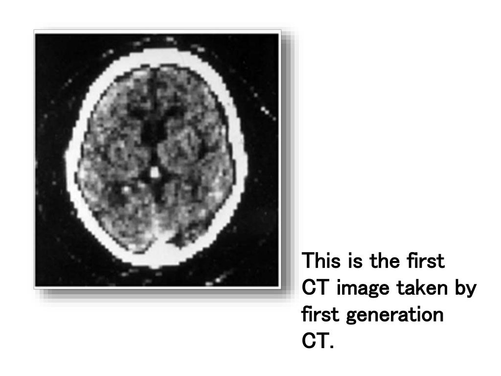 Basic principle of ct and ct generations