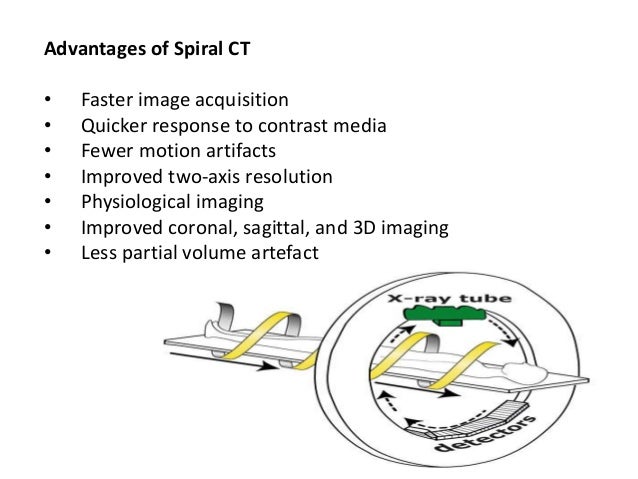 Basic principle of ct and ct generations