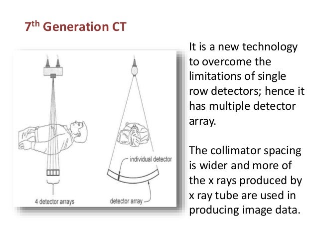 Basic principle of ct and ct generations