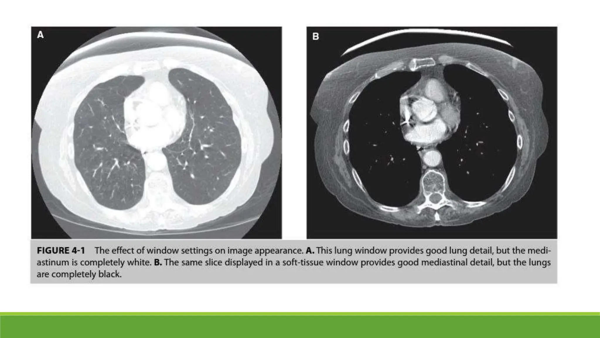 Basic principle of CT and generation of CT.pptx
