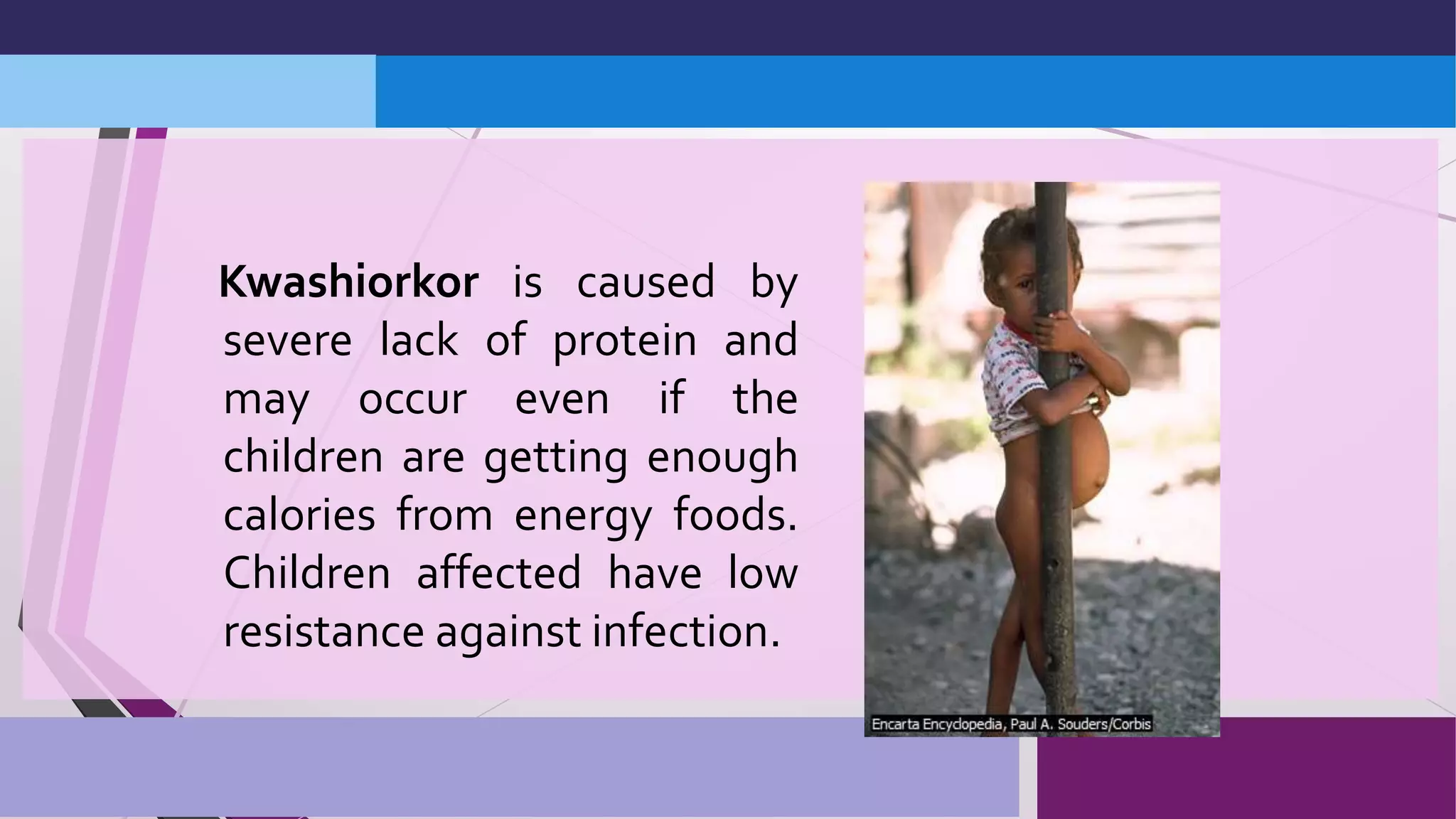 Basic principle of good and proper nutrition | PPTX