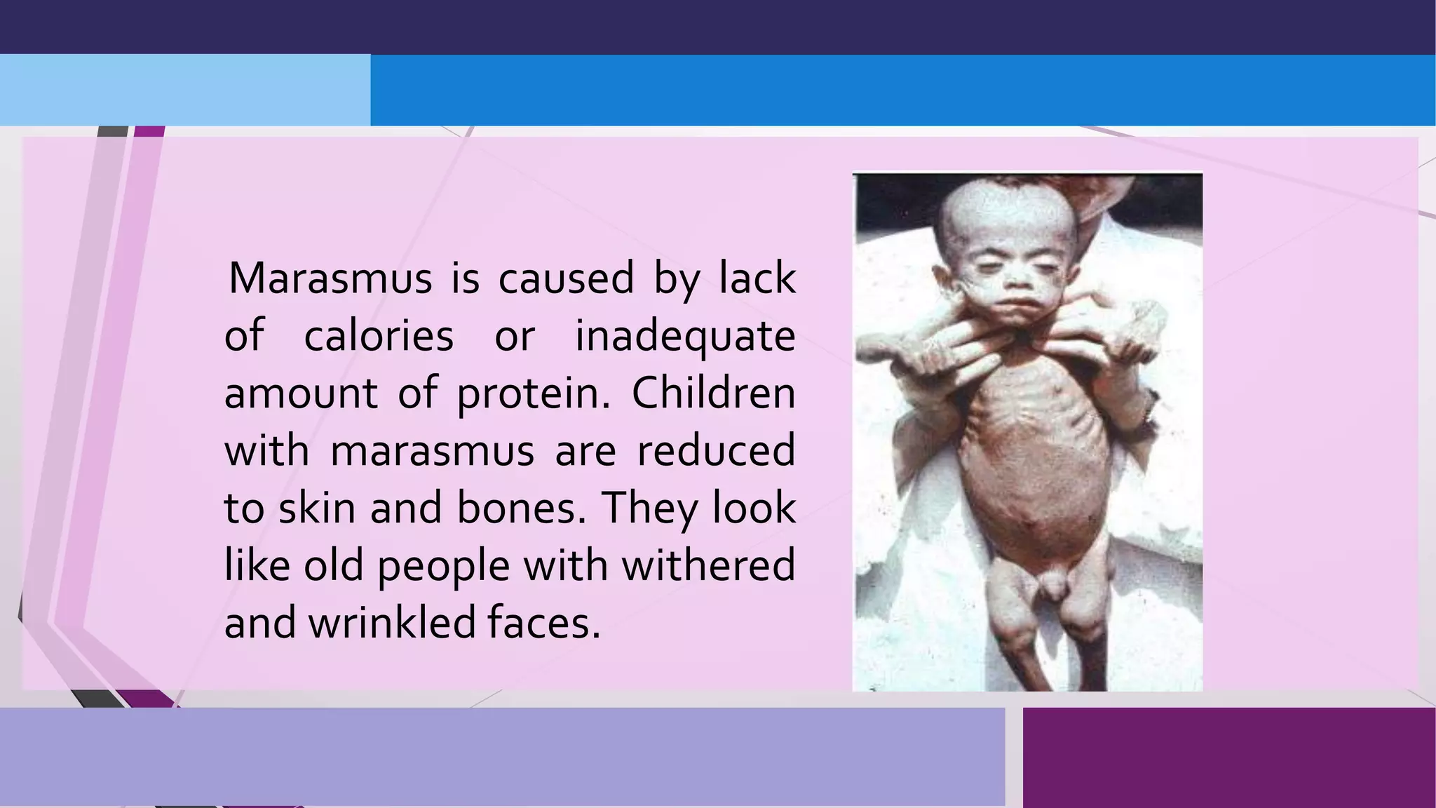 Basic principle of good and proper nutrition | PPTX