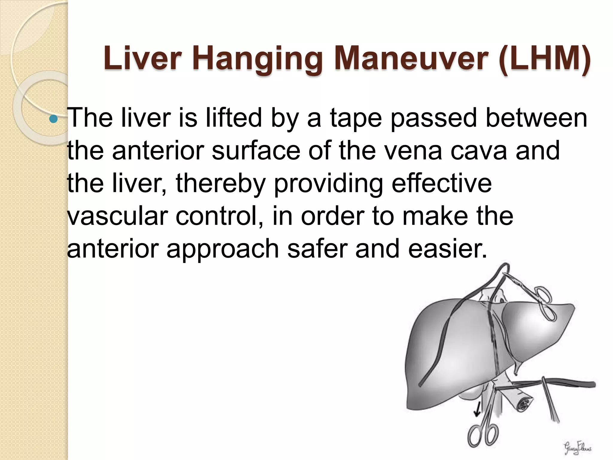 Basic principle of liver resection | PPTX | Surgery | Medical Health