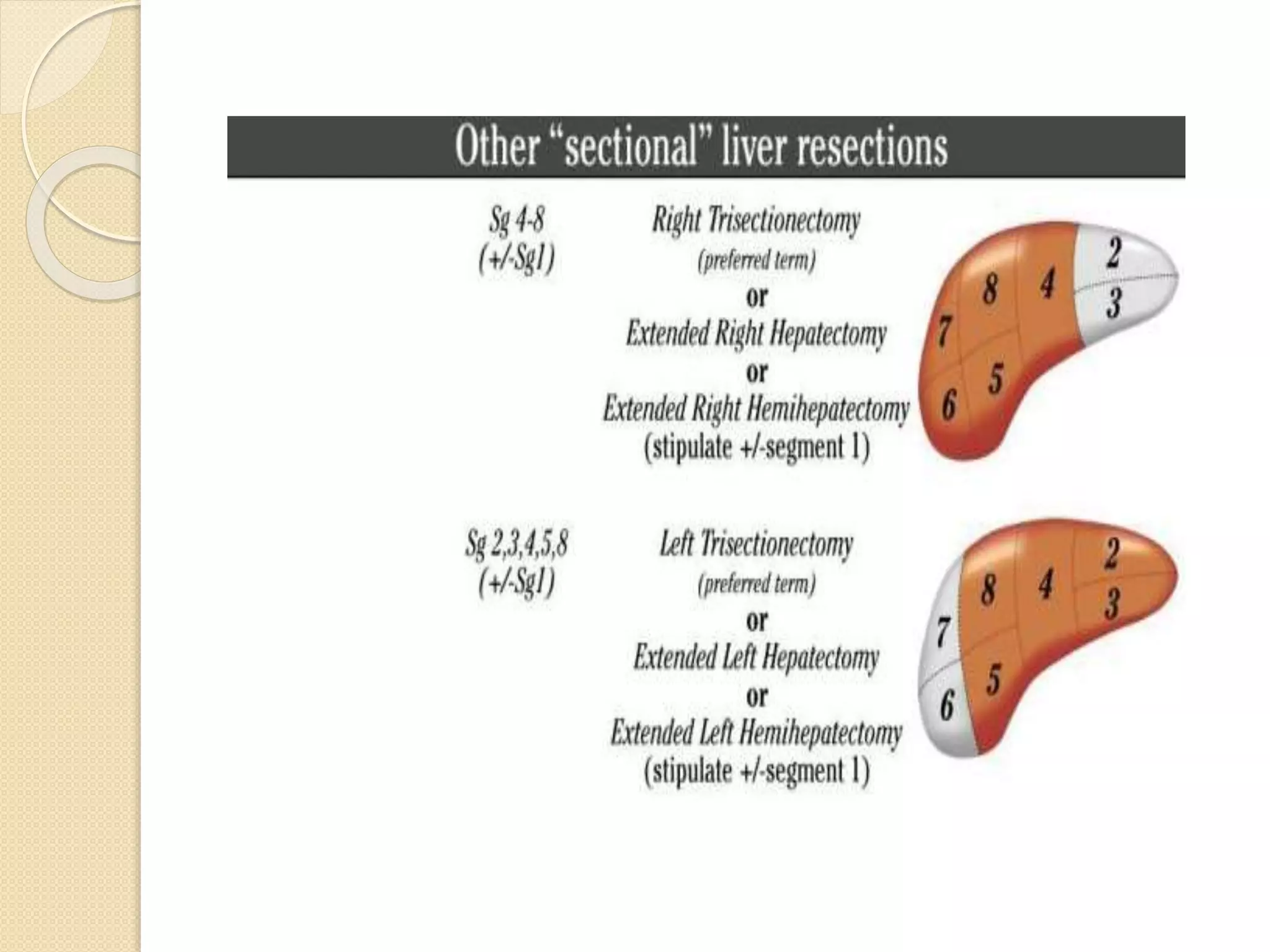 Basic principle of liver resection | PPTX