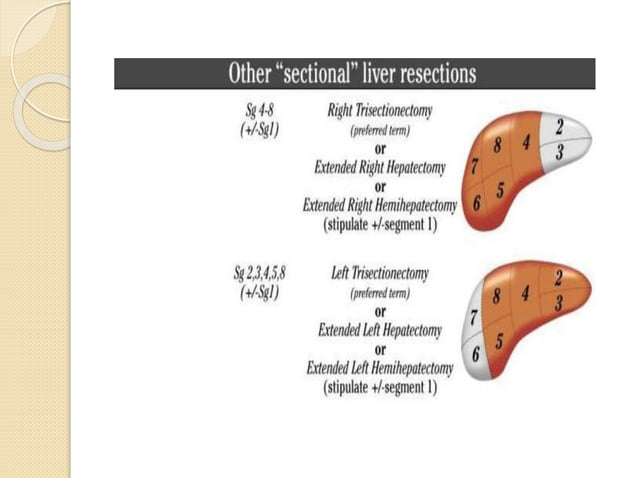 Basic principle of liver resection | PPTX | Surgery | Medical Health