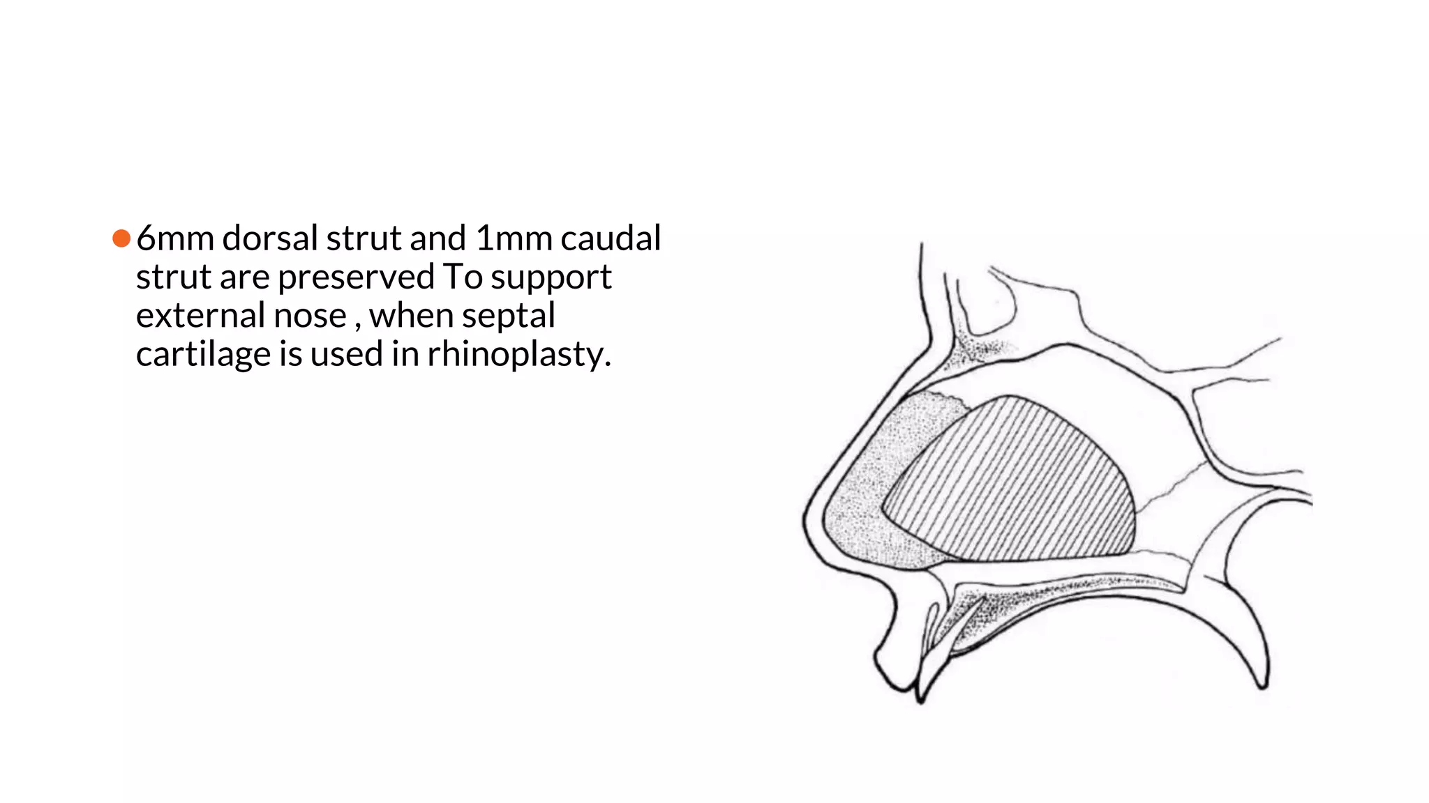 Basic principle of rhinoplasty. by venukumar.t | PPTX